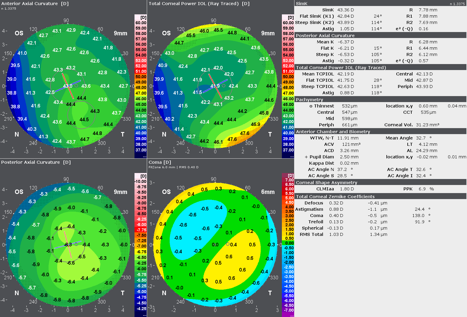GALILEI G6 ColorZ / Ziemer Ophthalmic Systems AG