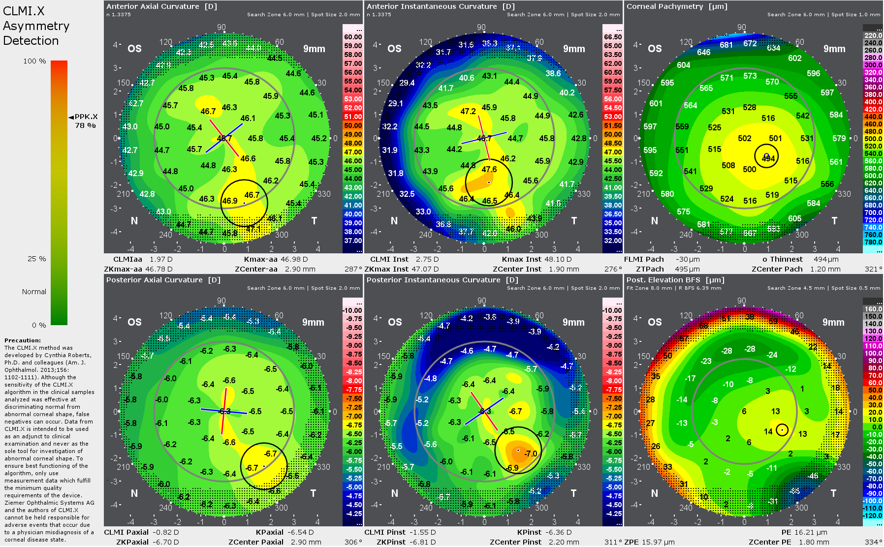 GALILEI G6 ColorZ / Ziemer Ophthalmic Systems AG