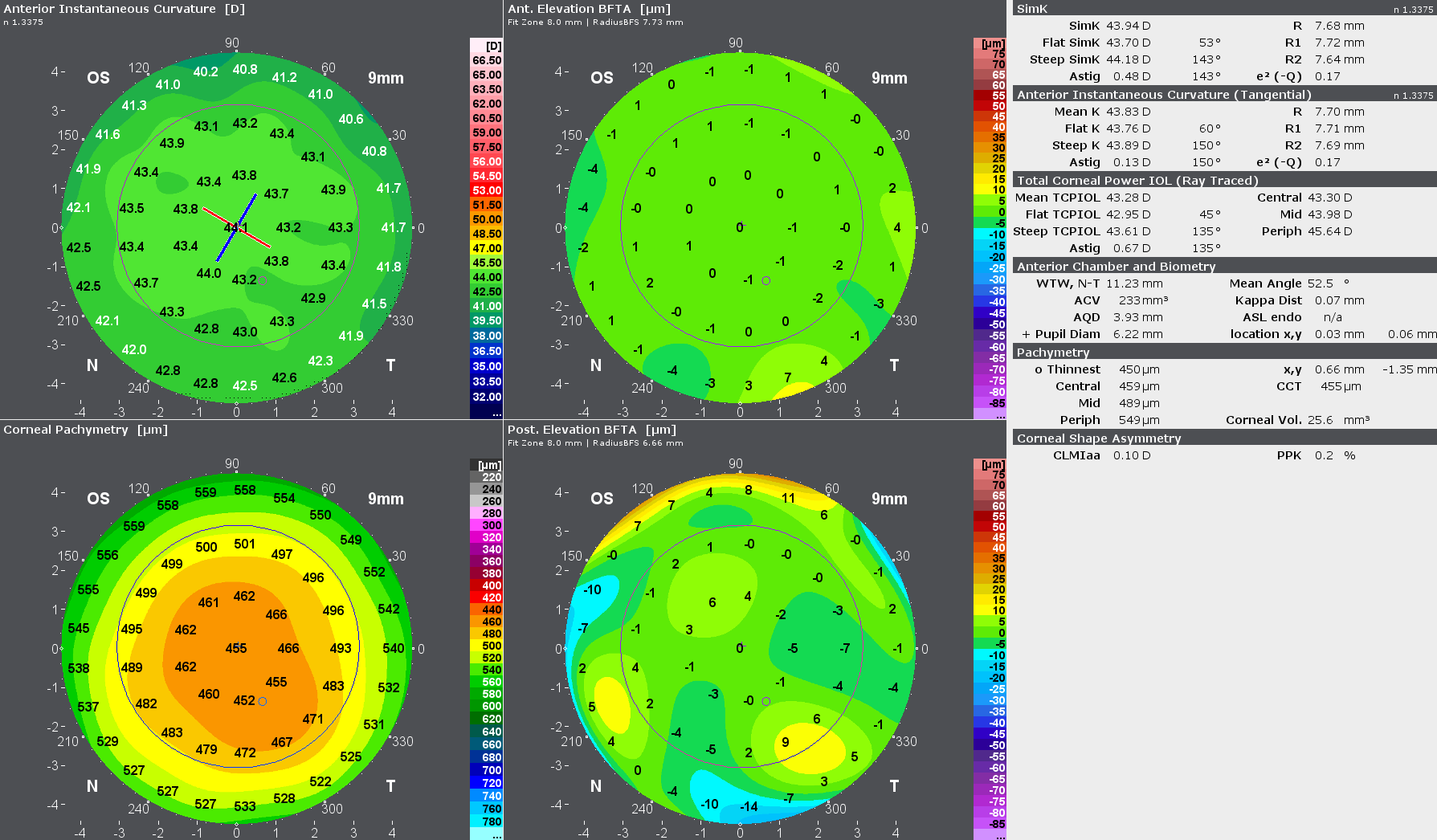 GALILEI G6 ColorZ / Ziemer Ophthalmic Systems AG