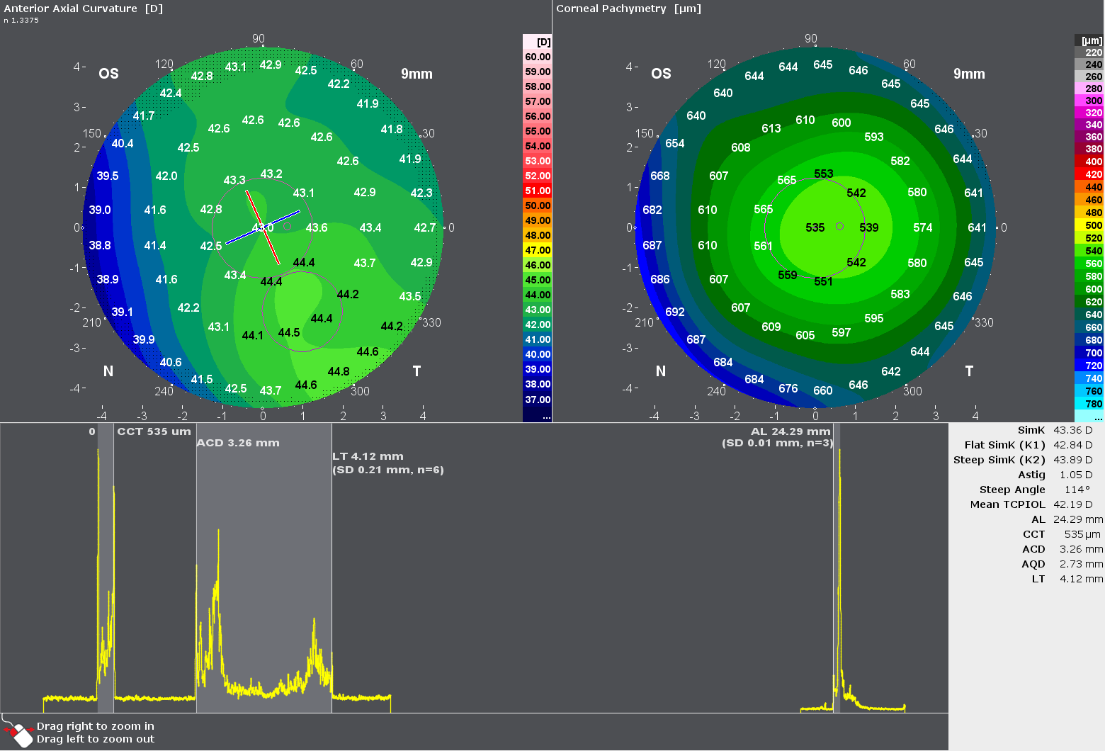 GALILEI G6 ColorZ / Ziemer Ophthalmic Systems AG