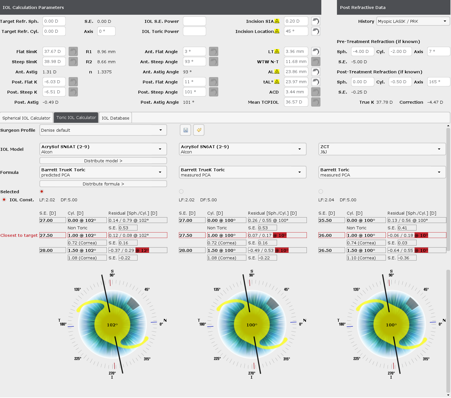 GALILEI G6 ColorZ / Ziemer Ophthalmic Systems AG
