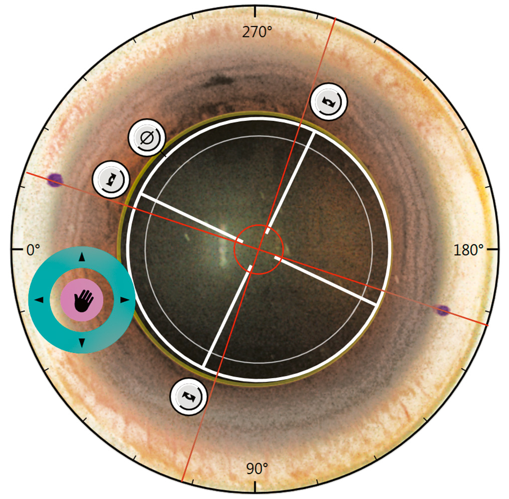 CLEAR / Ziemer Ophthalmic Systems AG