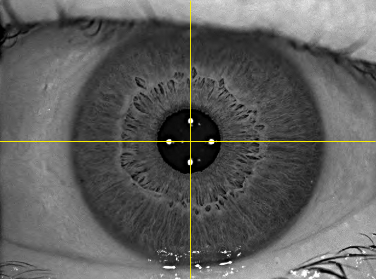 GALILEI G6 ColorZ / Ziemer Ophthalmic Systems AG