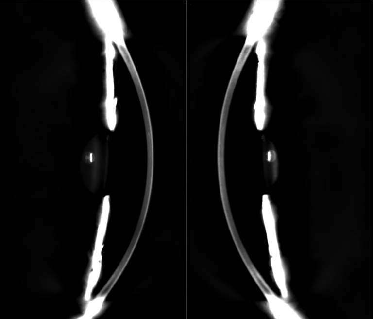 GALILEI G6 ColorZ / Ziemer Ophthalmic Systems AG