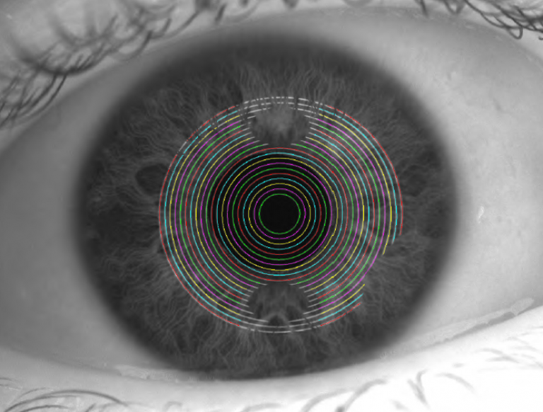 GALILEI G6 ColorZ / Ziemer Ophthalmic Systems AG